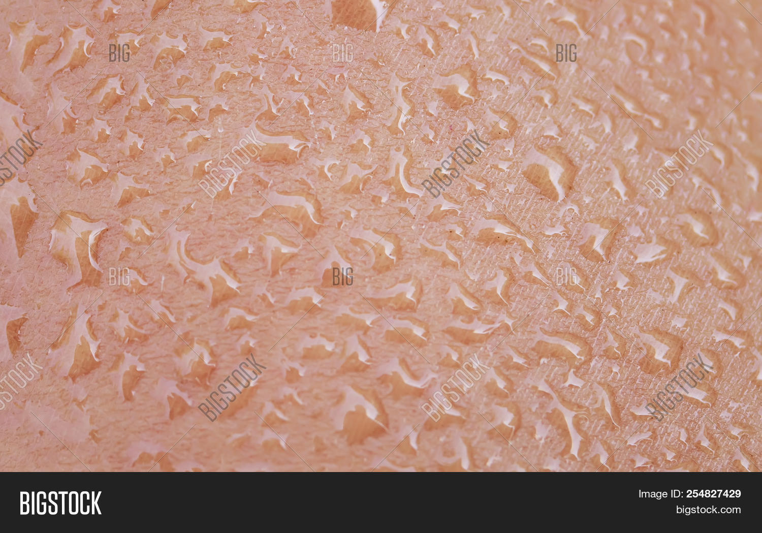 Texture Human Skin Image & Photo (Free Trial) | Bigstock