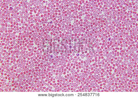 Human White Blood Cells Under Microscope