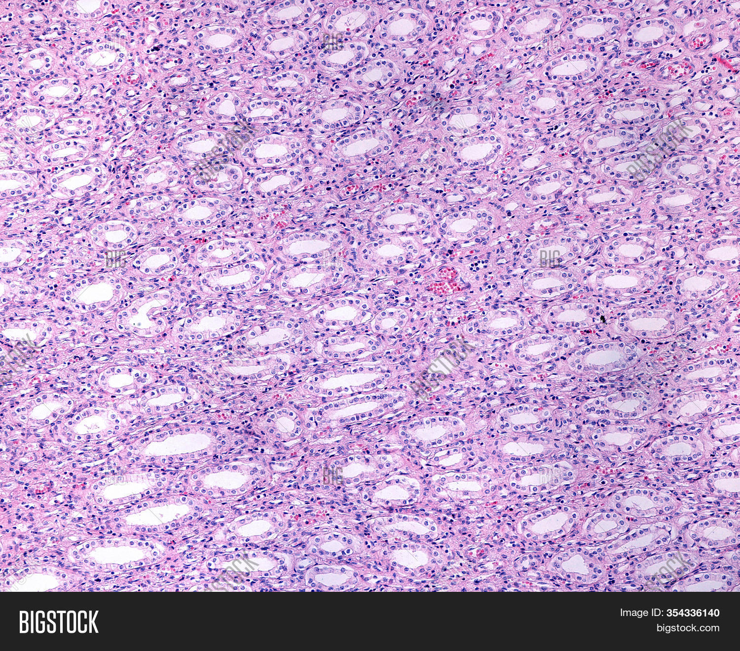 Low Magnification Image & Photo (Free Trial) | Bigstock