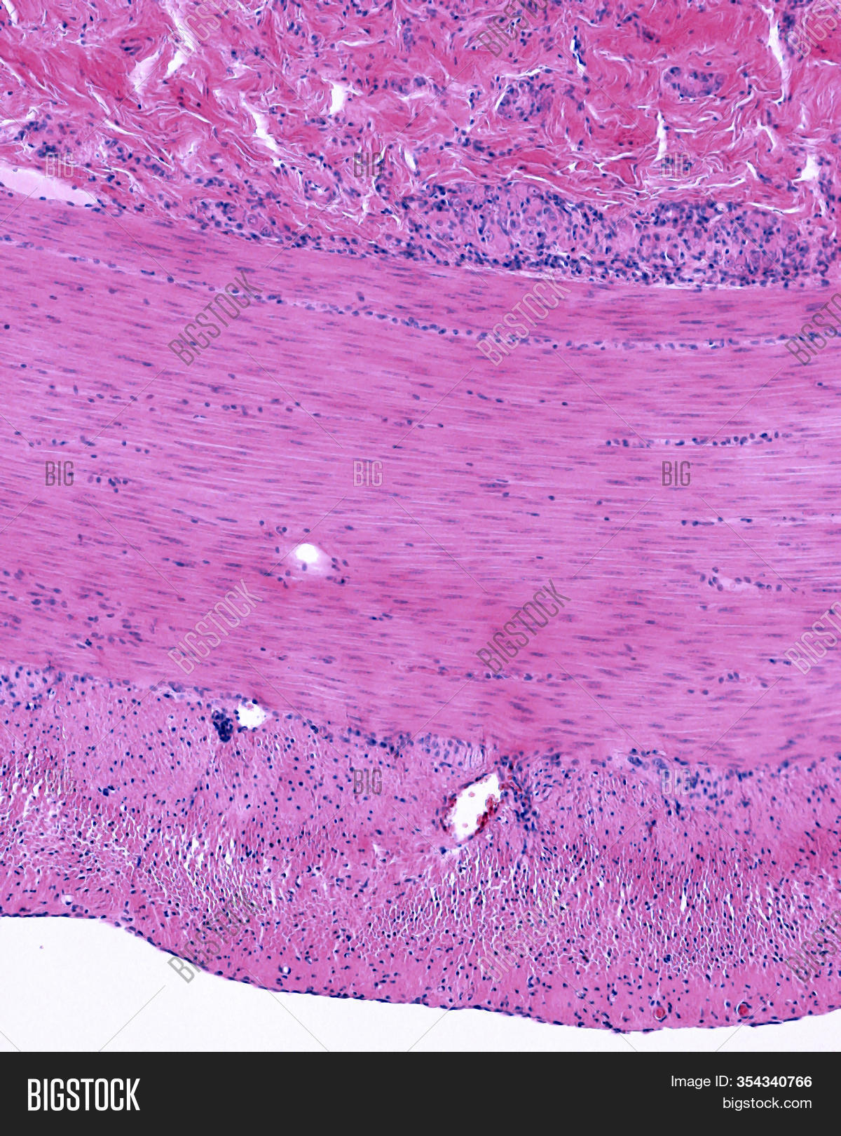 Muscular Layer Small Image & Photo (Free Trial) | Bigstock