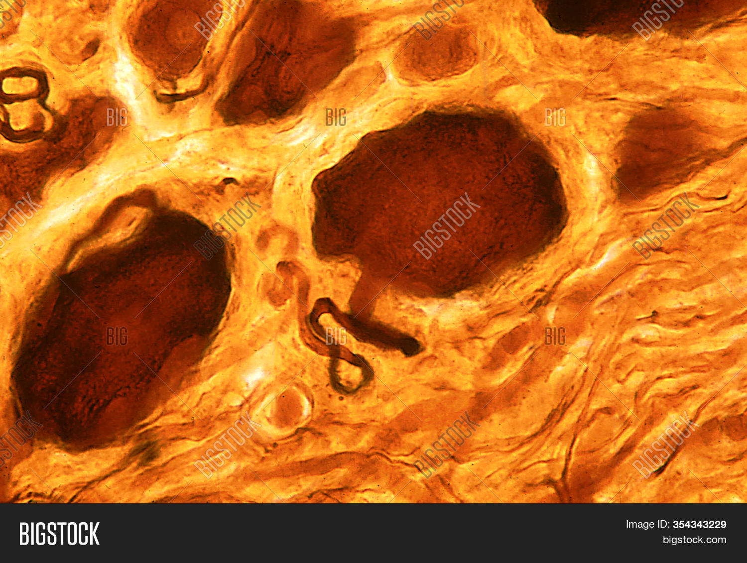 Pseudounipolar Neuron Slide