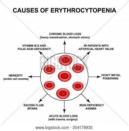 Causes Image & Photo (Free Trial) | Bigstock