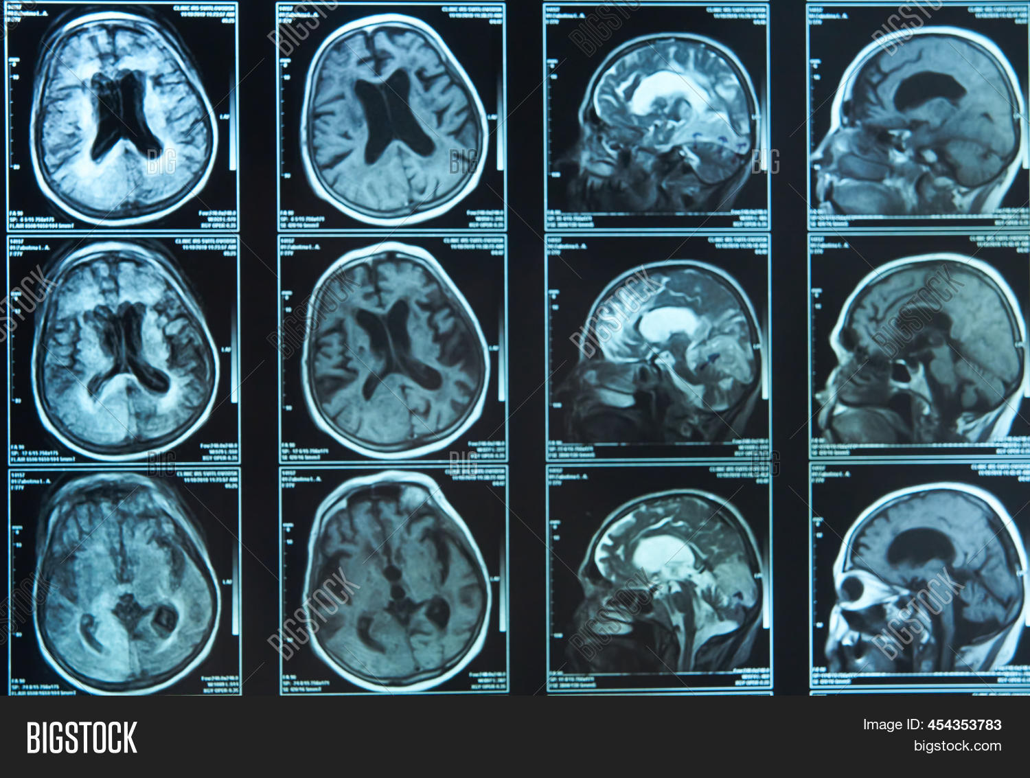 Snapshot Elderly Image & Photo (Free Trial) | Bigstock