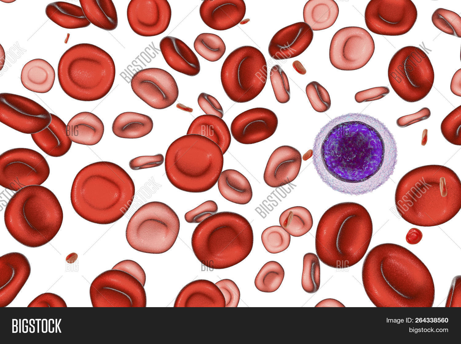 Hemotransfusion Image & Photo (Free Trial) | Bigstock