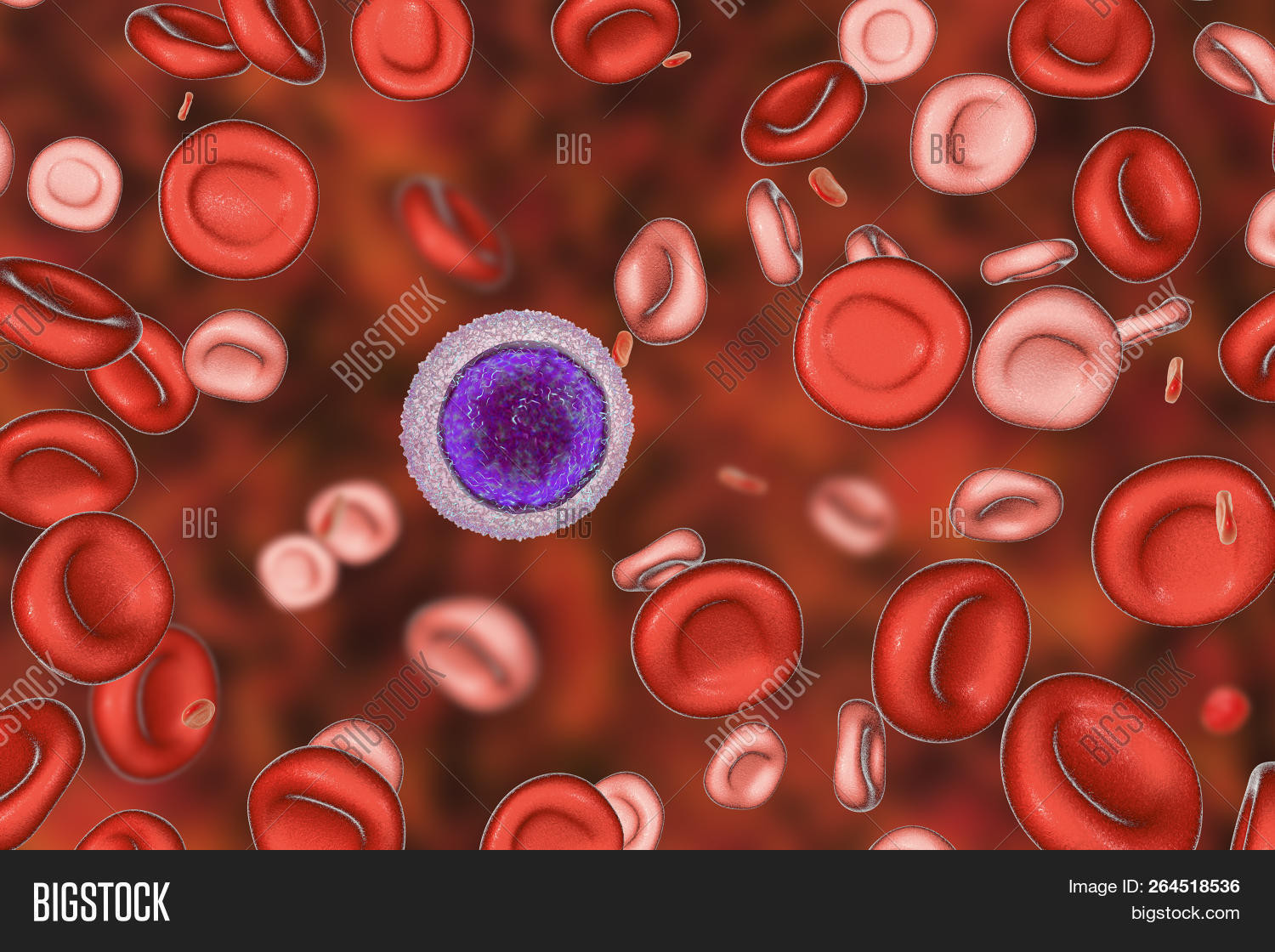 Hemotransfusion Image & Photo (Free Trial) | Bigstock