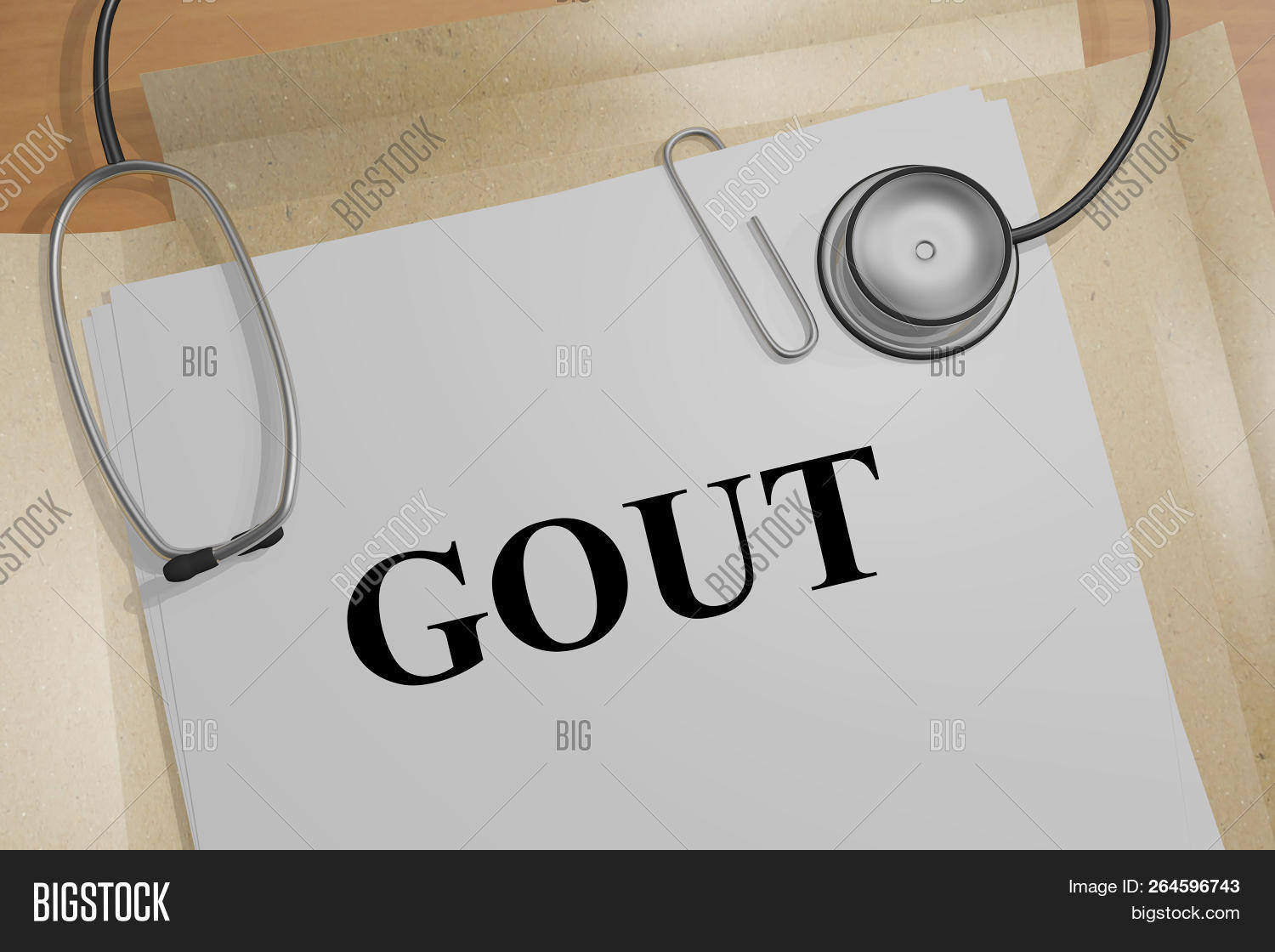 3d Illustration Gout Image & Photo (Free Trial) | Bigstock