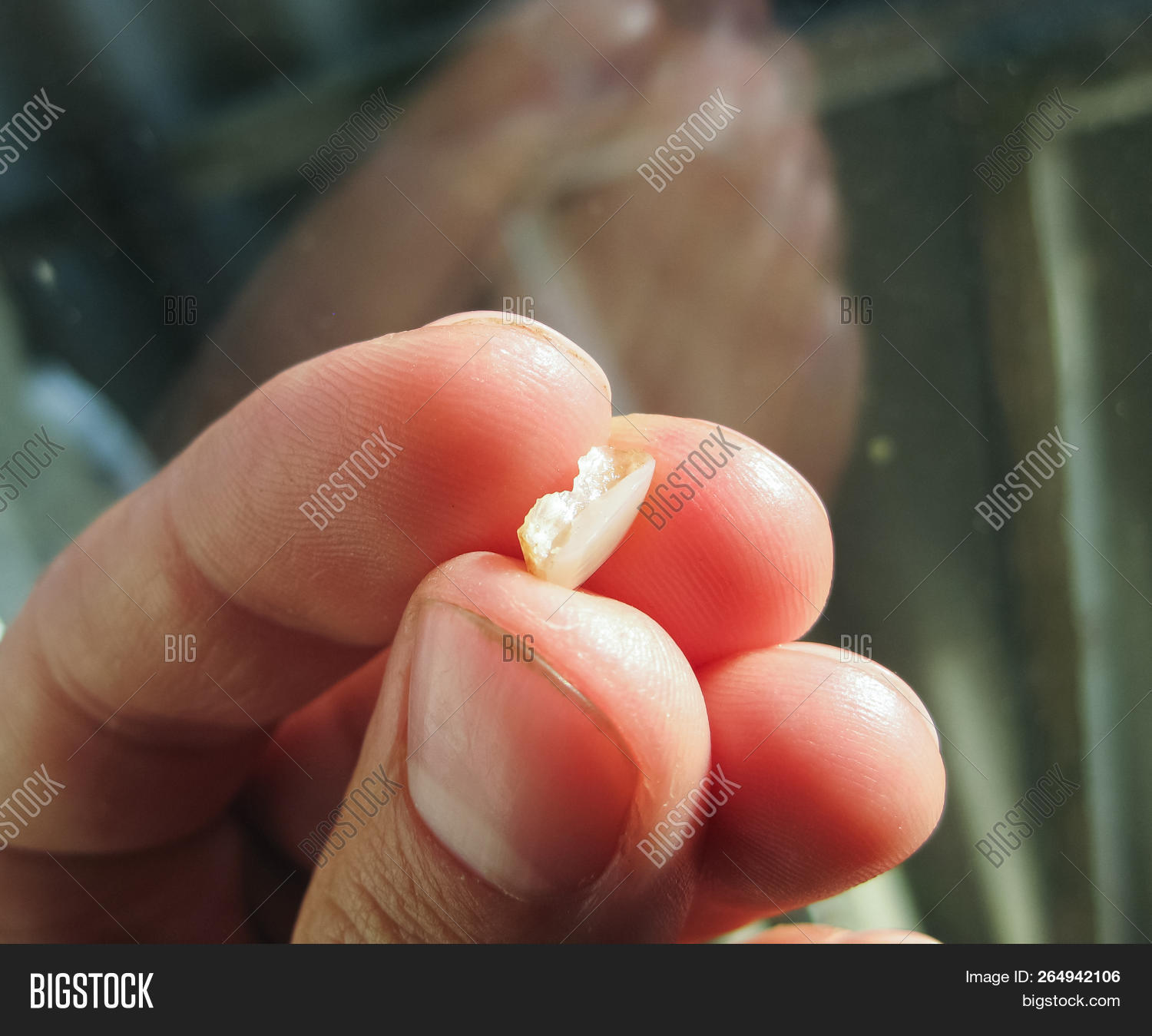 Fallen Off Old Filling Image & Photo (Free Trial) | Bigstock