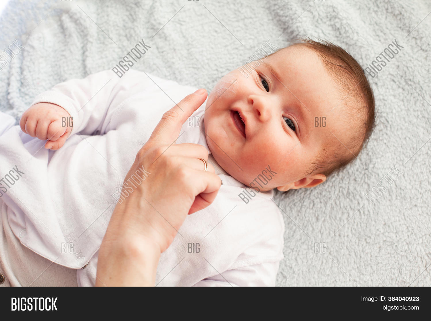 Baby Atopic Dermatitis Image & Photo (Free Trial) | Bigstock