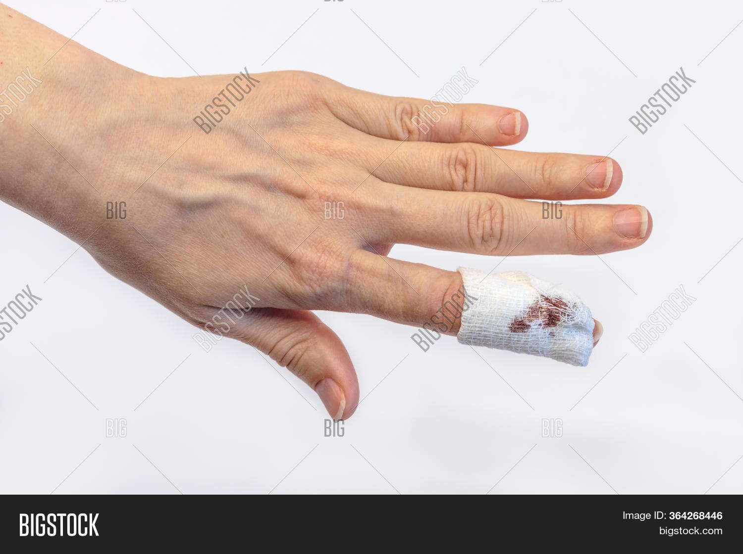 Injured Second Finger Image & Photo (Free Trial) | Bigstock