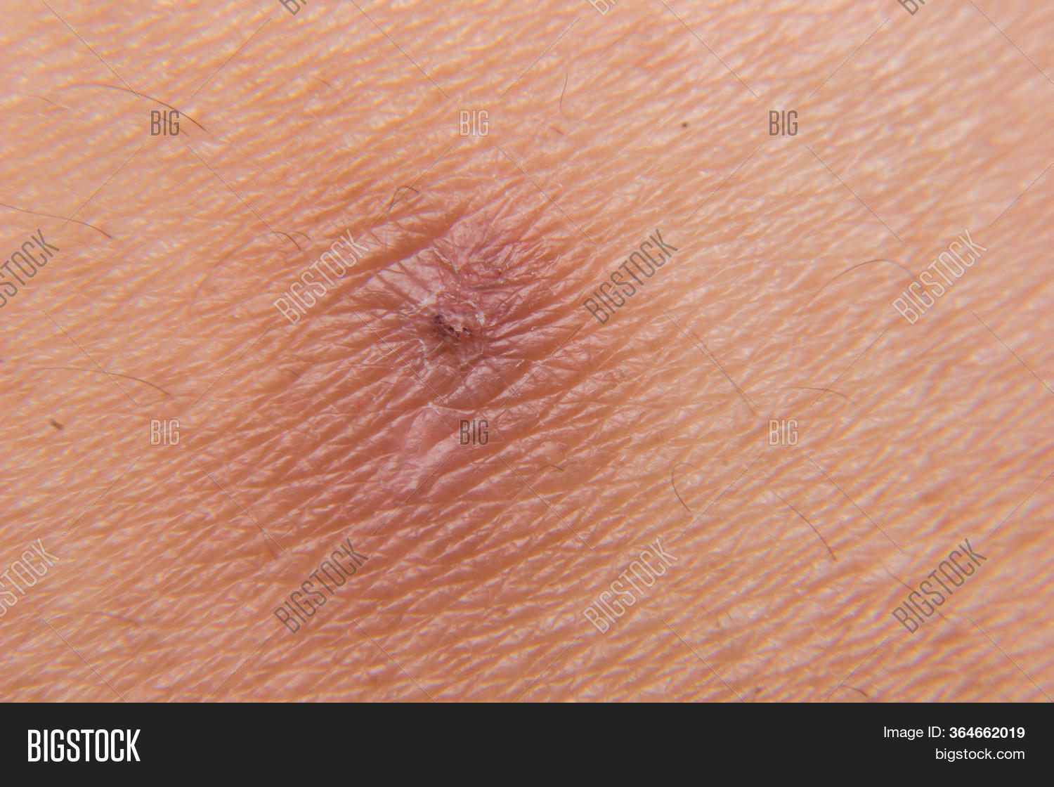 Macro Image Skin Image & Photo (Free Trial) | Bigstock