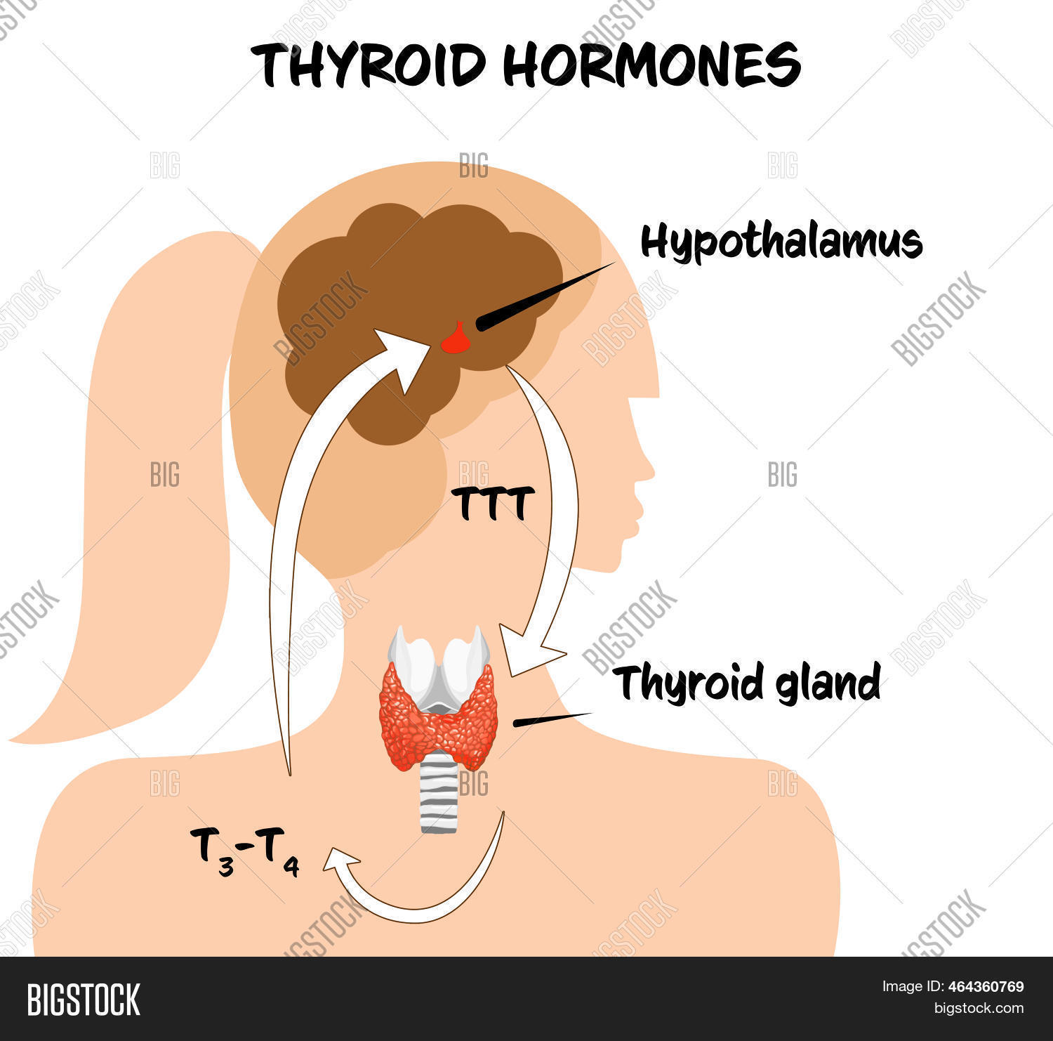 Medical Poster Thyroid Image & Photo (Free Trial) | Bigstock