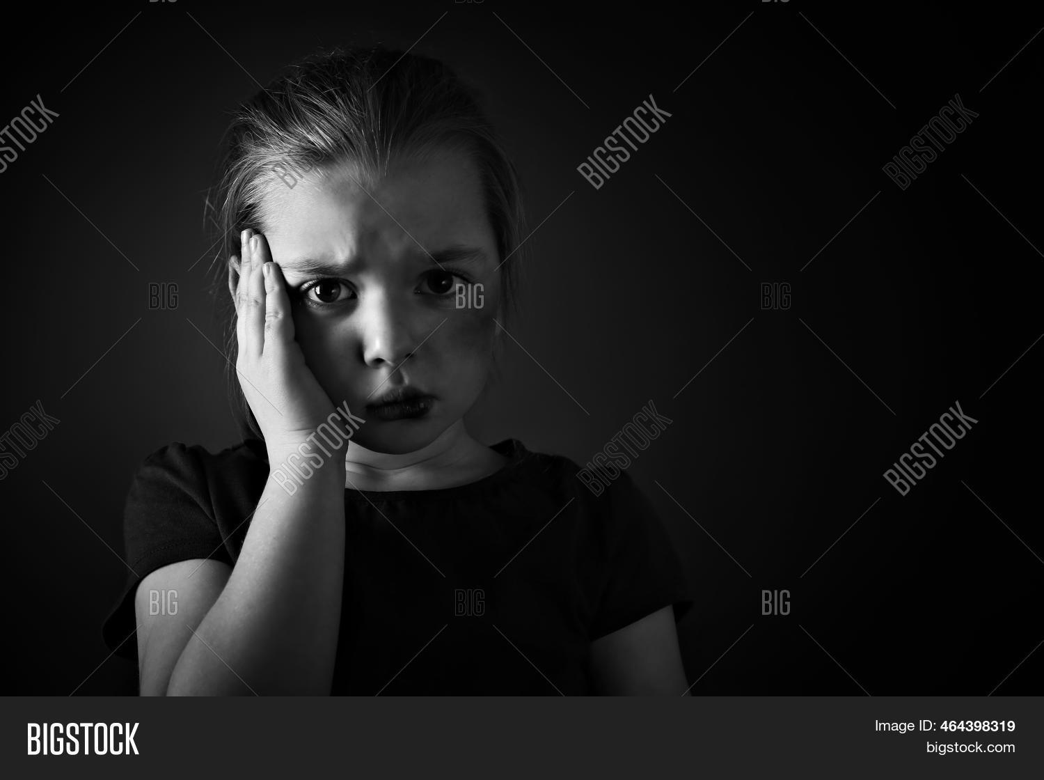 Little Girl Bruises On Image & Photo (Free Trial) | Bigstock
