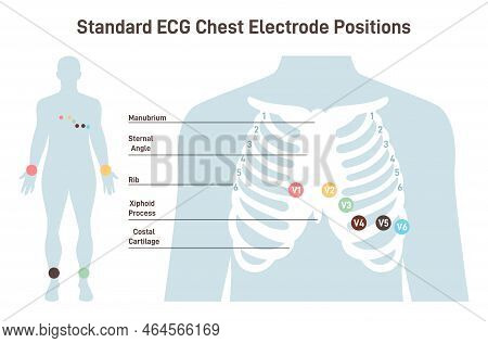 Position Ecg Chest Vector & Photo (Free Trial) | Bigstock