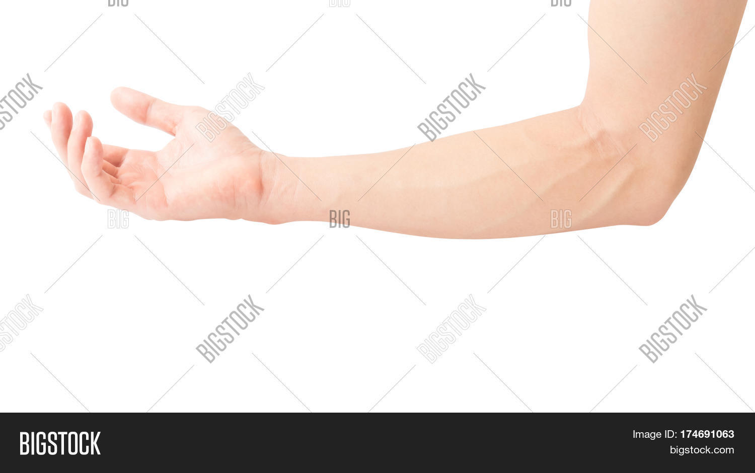 Man Arm Blood Veins On Image & Photo (Free Trial) | Bigstock