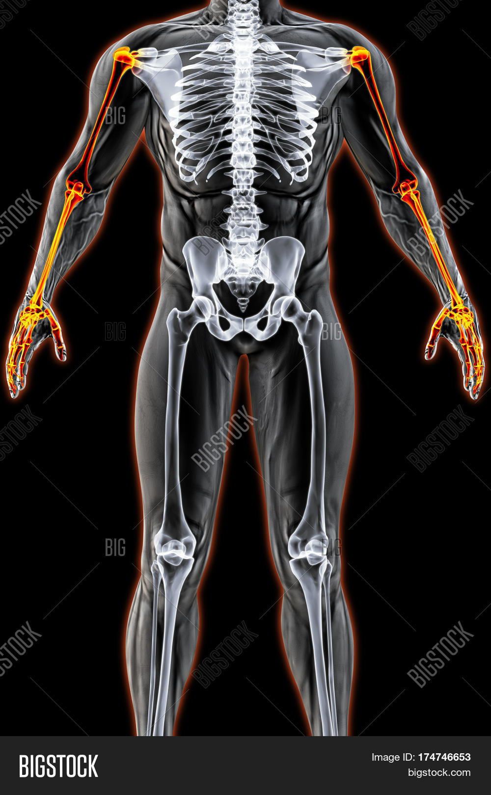 Male Body Under X-rays Image & Photo (Free Trial) | Bigstock