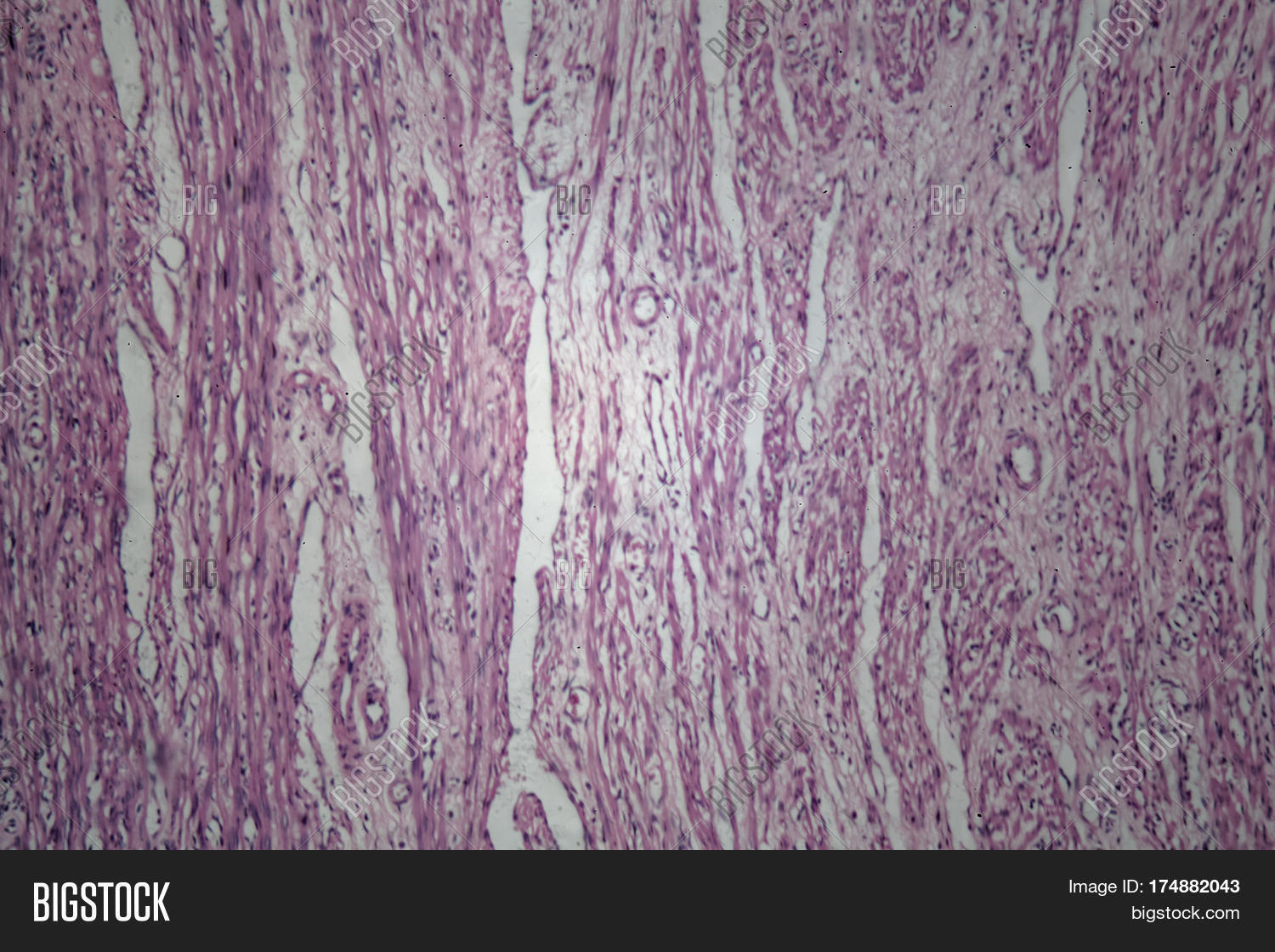 Cells Human Uterus Image & Photo (Free Trial) | Bigstock