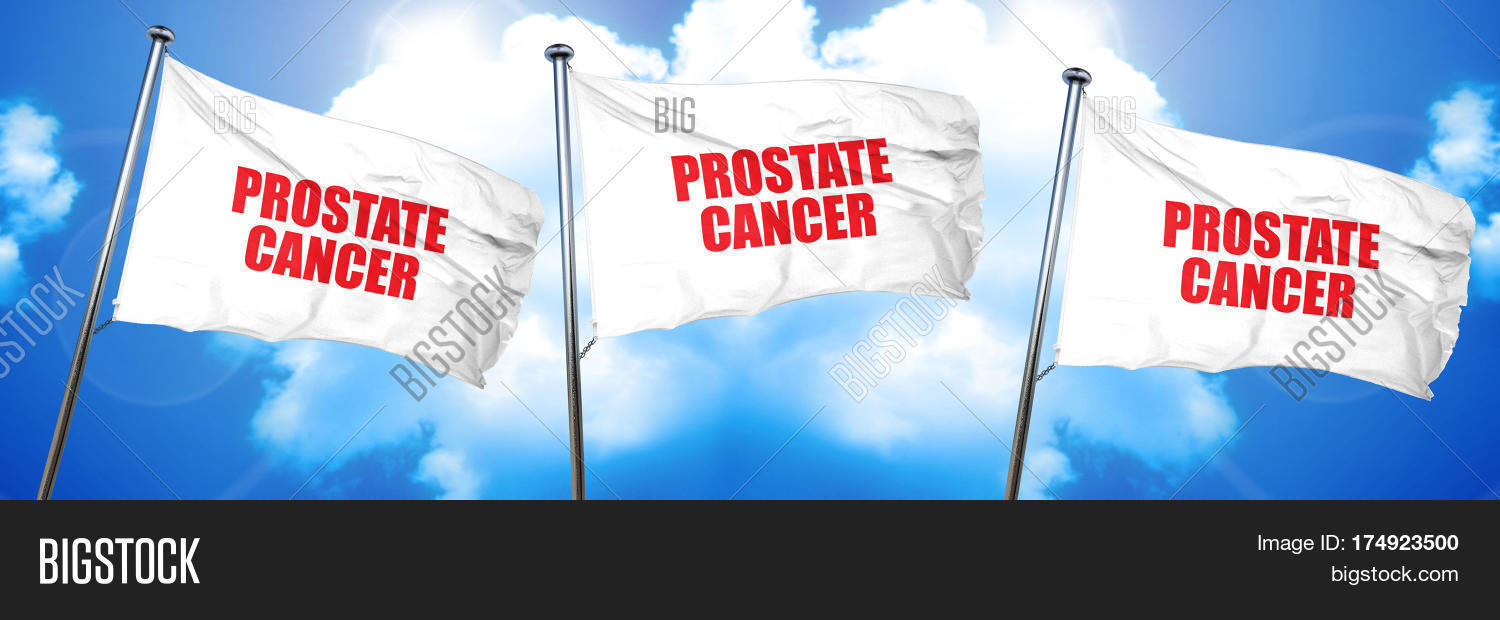 Prostate Cancer, 3D Image & Photo (Free Trial) | Bigstock