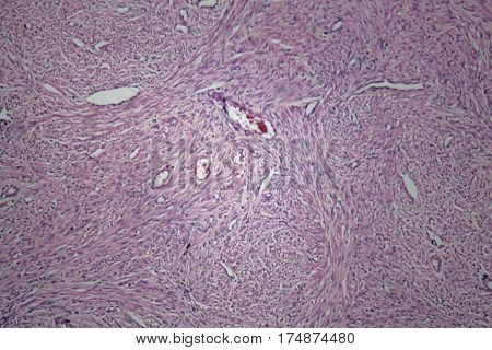 Cells Human Uterus Image & Photo (Free Trial) | Bigstock