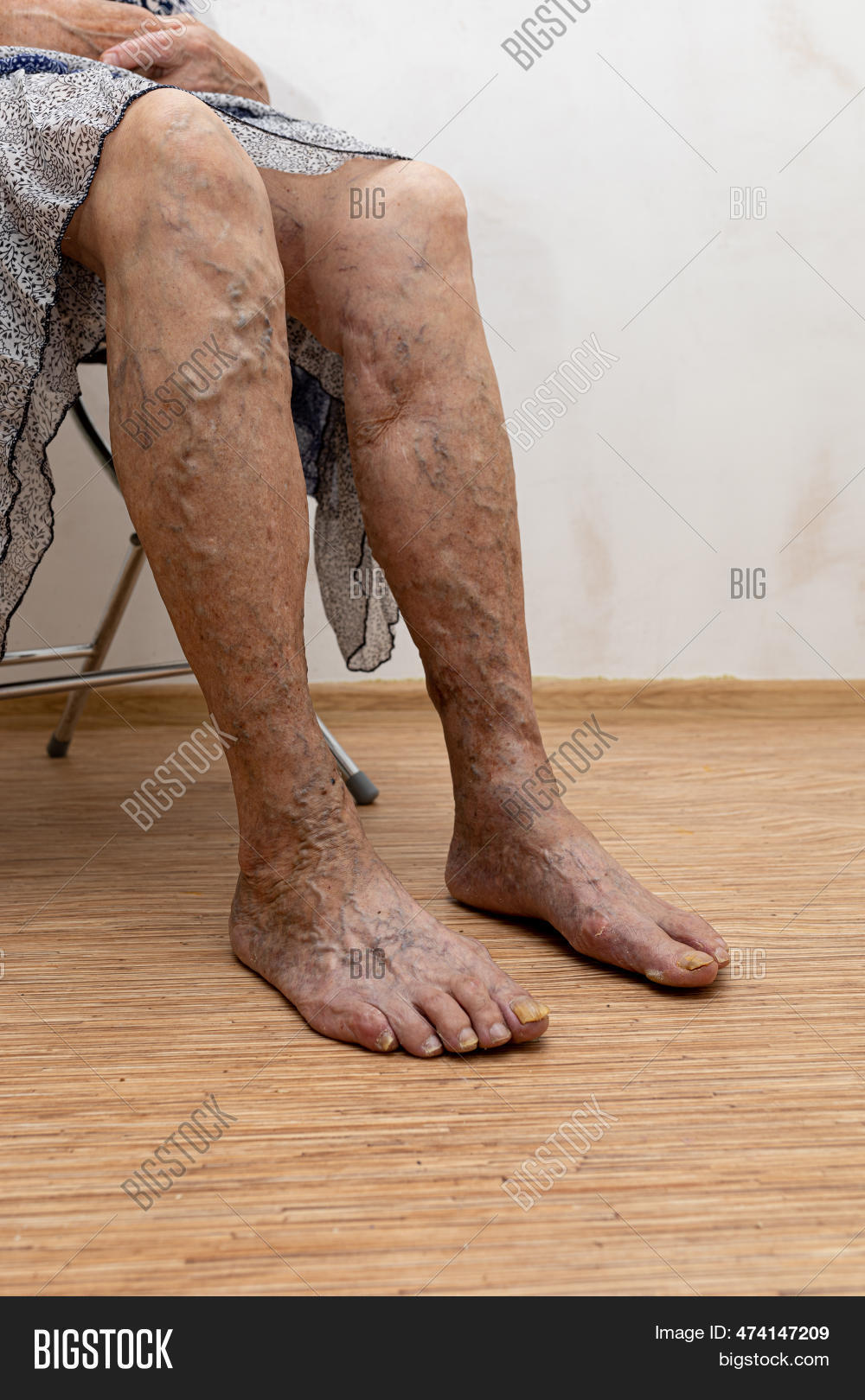 Senior Woman Legs Feet Image & Photo (Free Trial) | Bigstock