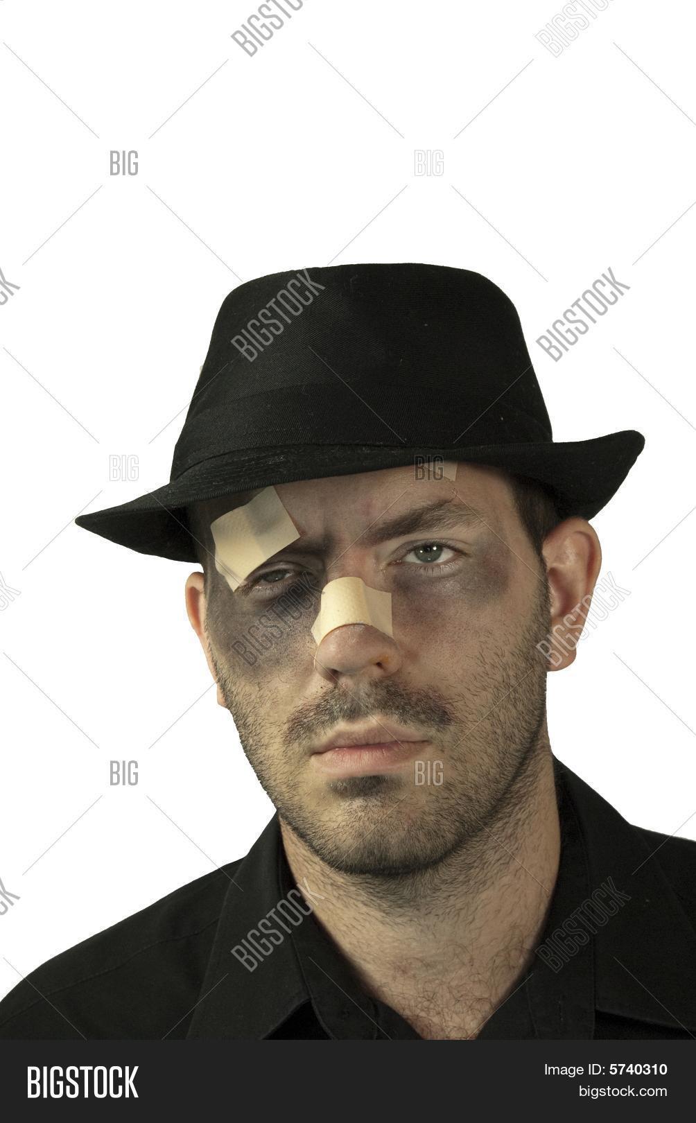 Injured Man Image & Photo (Free Trial) | Bigstock