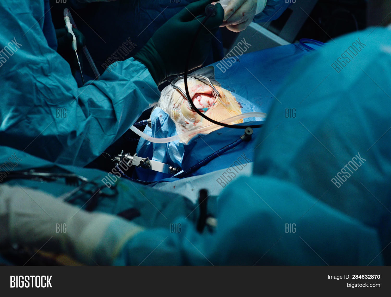 Neurosurgeons Perform Image & Photo (Free Trial) | Bigstock