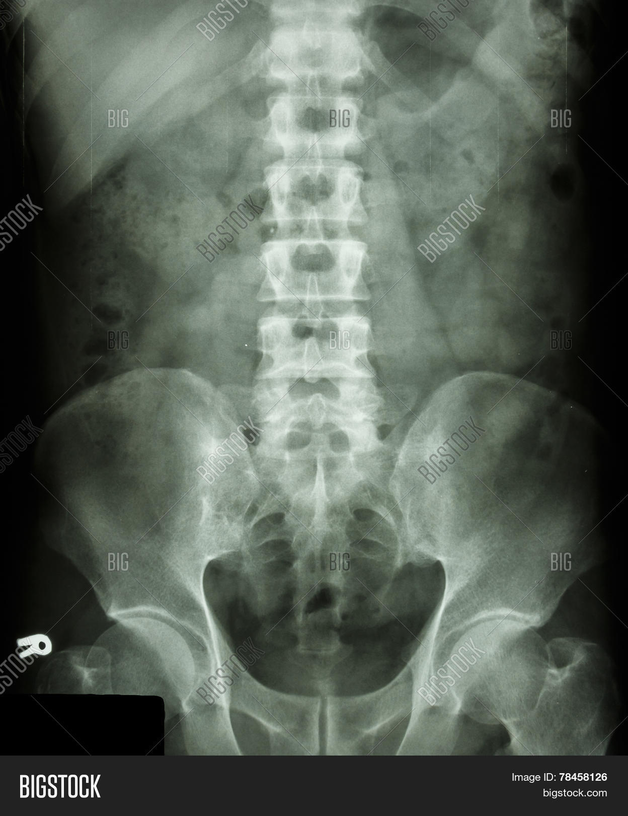 Normal Human's Image & Photo (Free Trial) | Bigstock