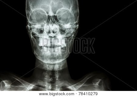 Normal Human's Skull Image & Photo (Free Trial) | Bigstock