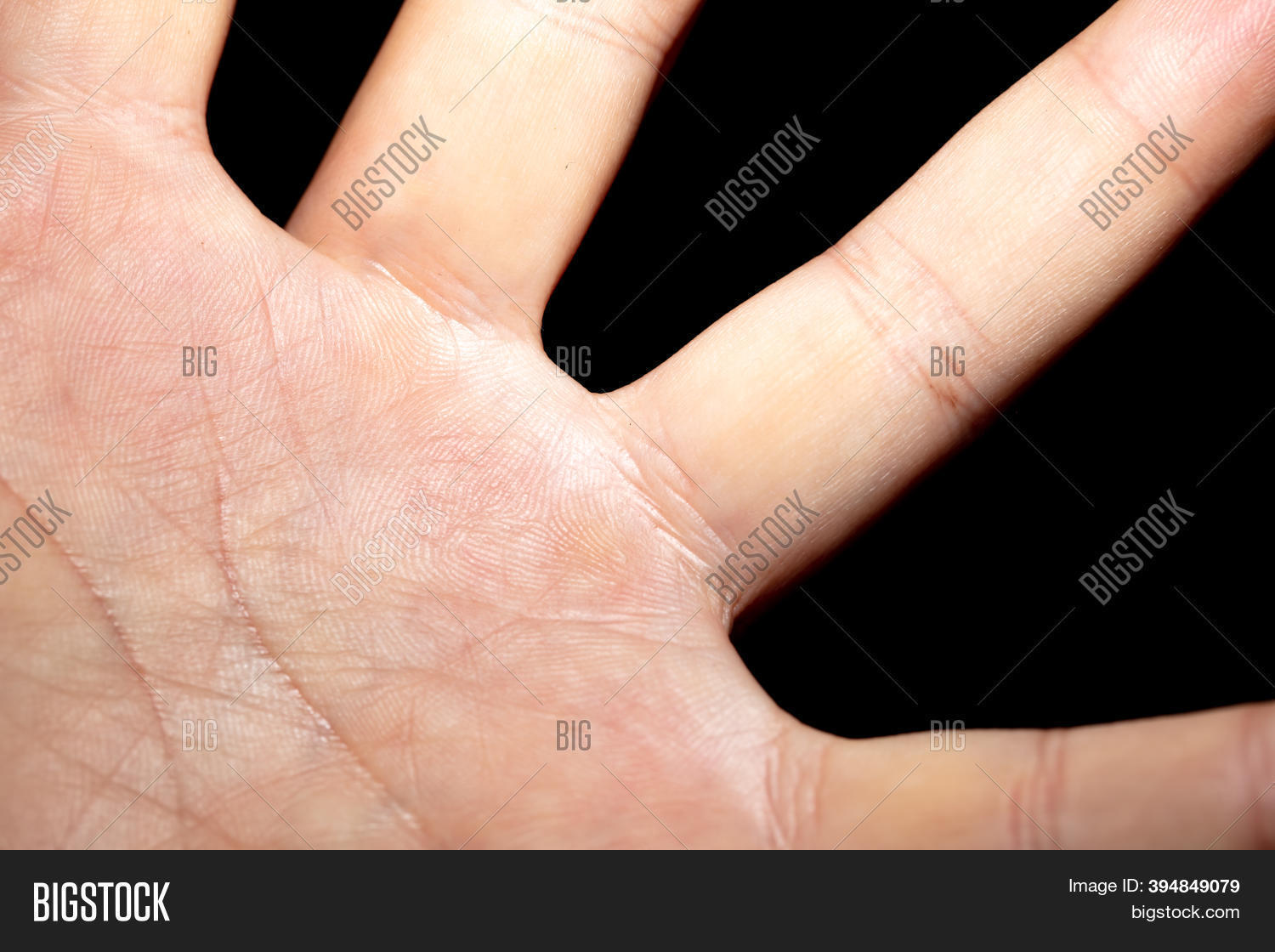 Close- Lines On Human Image & Photo (Free Trial) | Bigstock