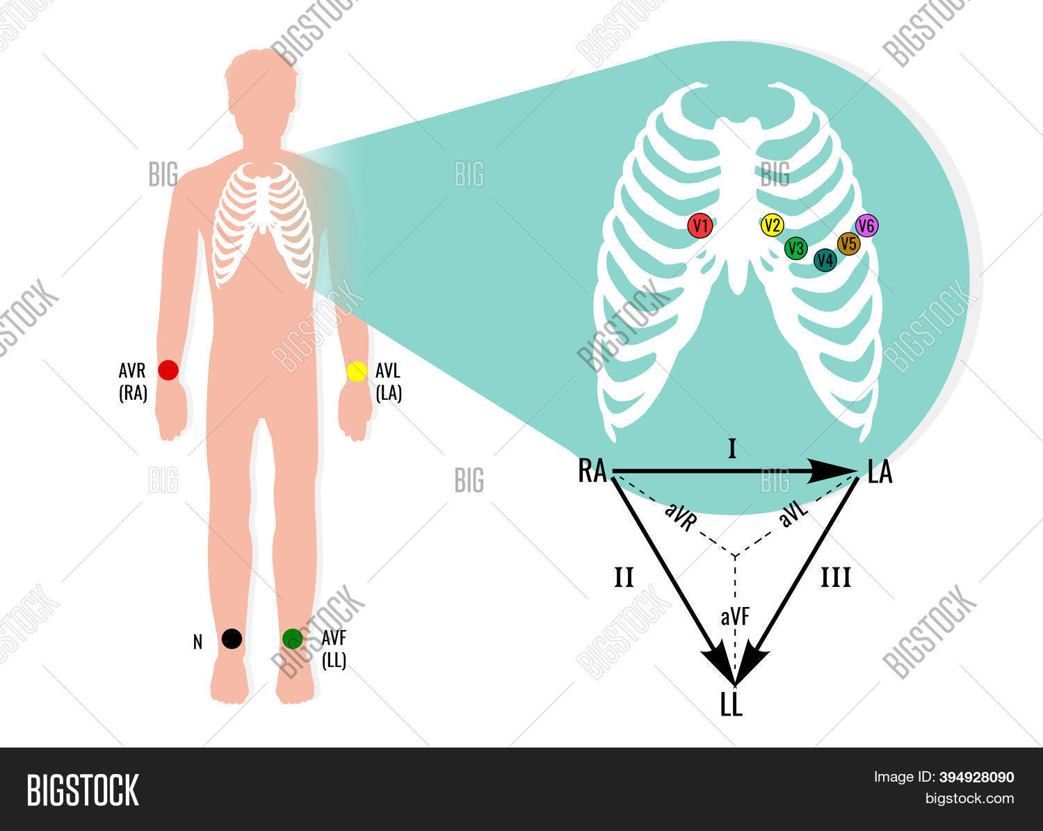 Ecg Electrode Position Image & Photo (Free Trial) | Bigstock