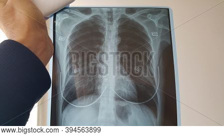 Doctor Checks X-ray Image & Photo (Free Trial) | Bigstock