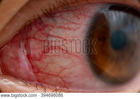 Closeup Irritated Image & Photo (Free Trial) | Bigstock