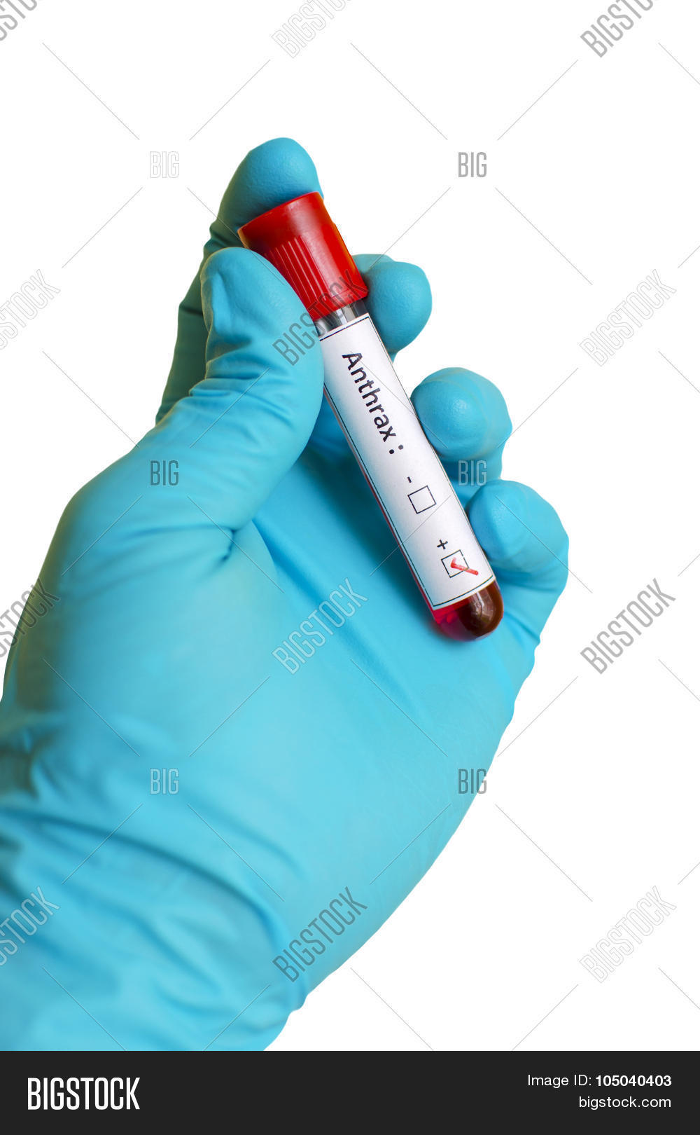 Anthrax Blood Sample Image & Photo (Free Trial) | Bigstock