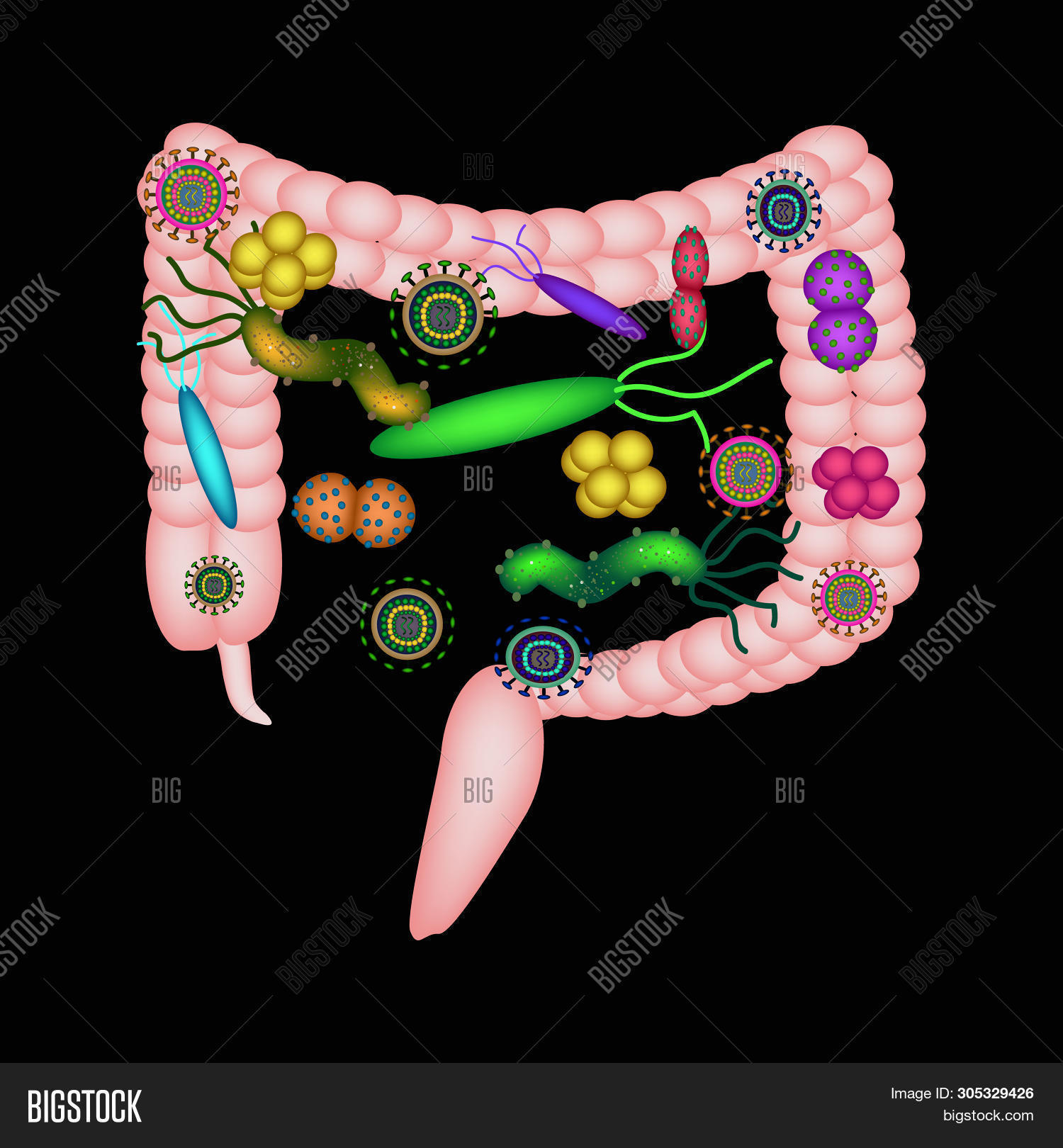 Dysbacteriosis Image & Photo (Free Trial) | Bigstock