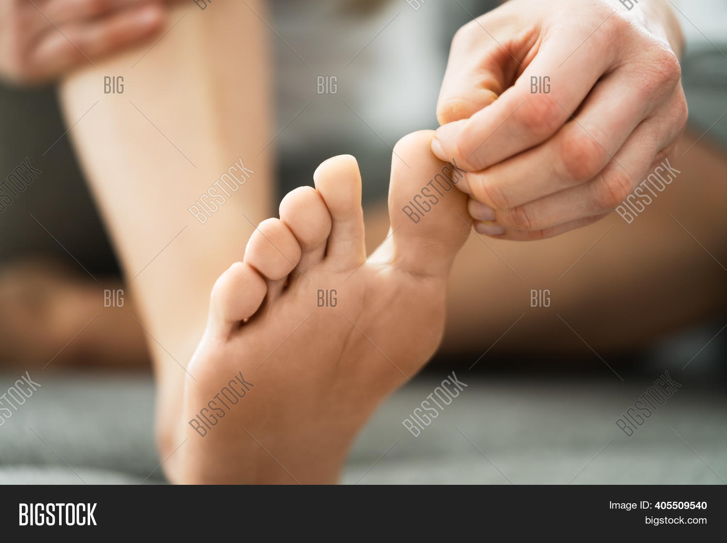 Hand Scratching Sore Image & Photo (Free Trial) | Bigstock