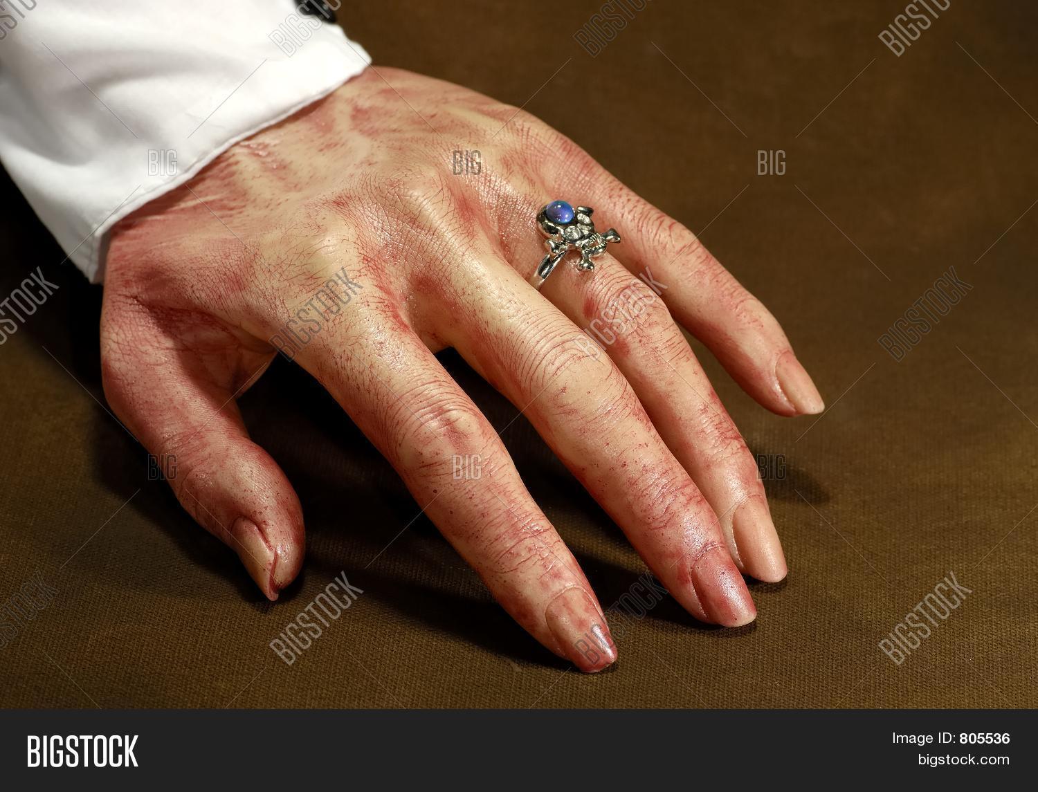 Bloody Hand Image & Photo (Free Trial) | Bigstock