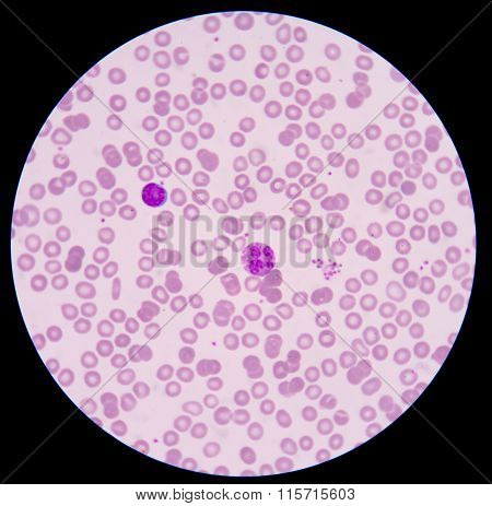 Blood Smear Image & Photo (Free Trial) | Bigstock