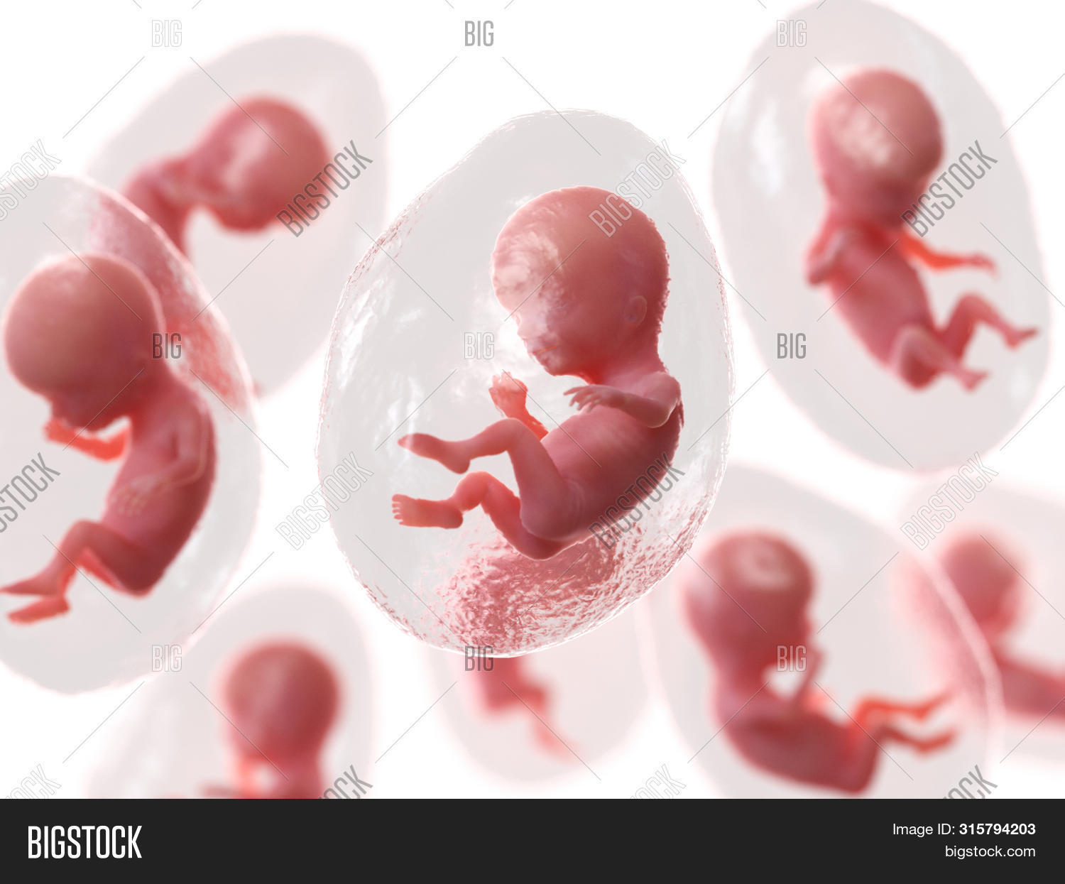 3d Rendered Medically Image & Photo (Free Trial) | Bigstock