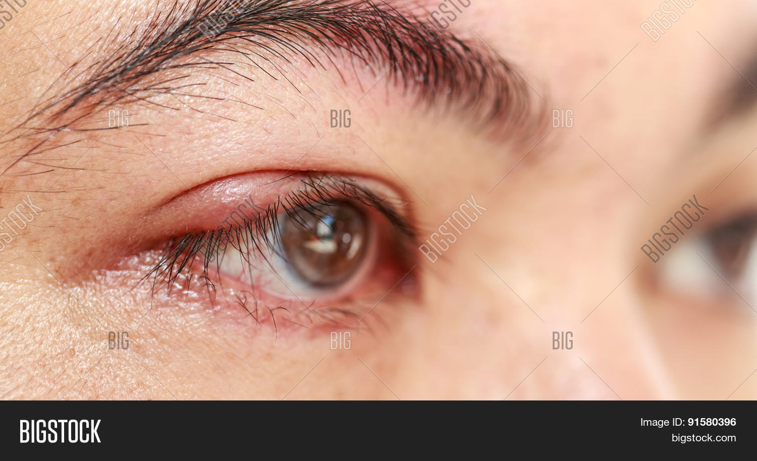 Right Upper Eye Lid Image & Photo (Free Trial) | Bigstock