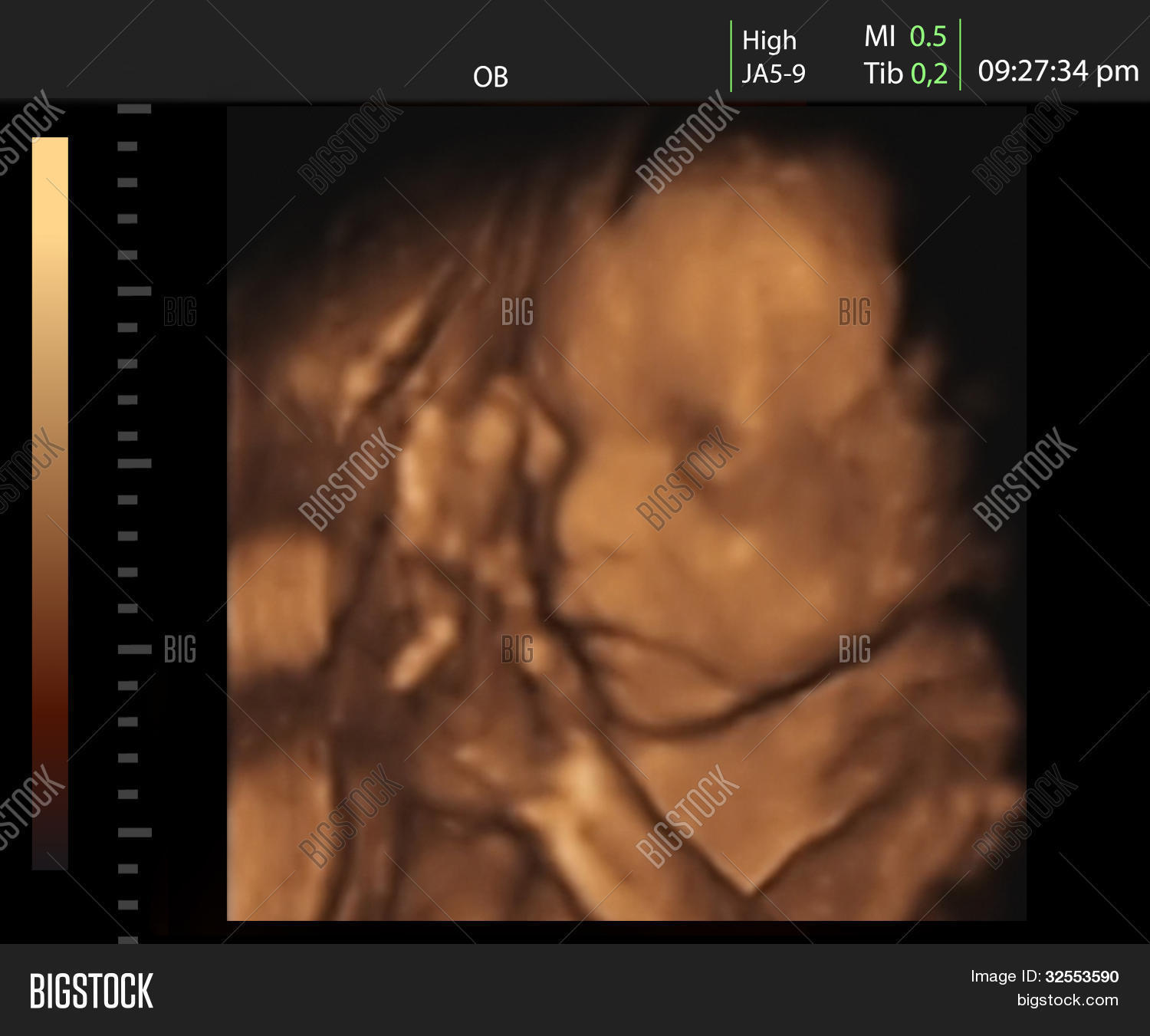 3D Ultrasound Baby Image & Photo (Free Trial) | Bigstock