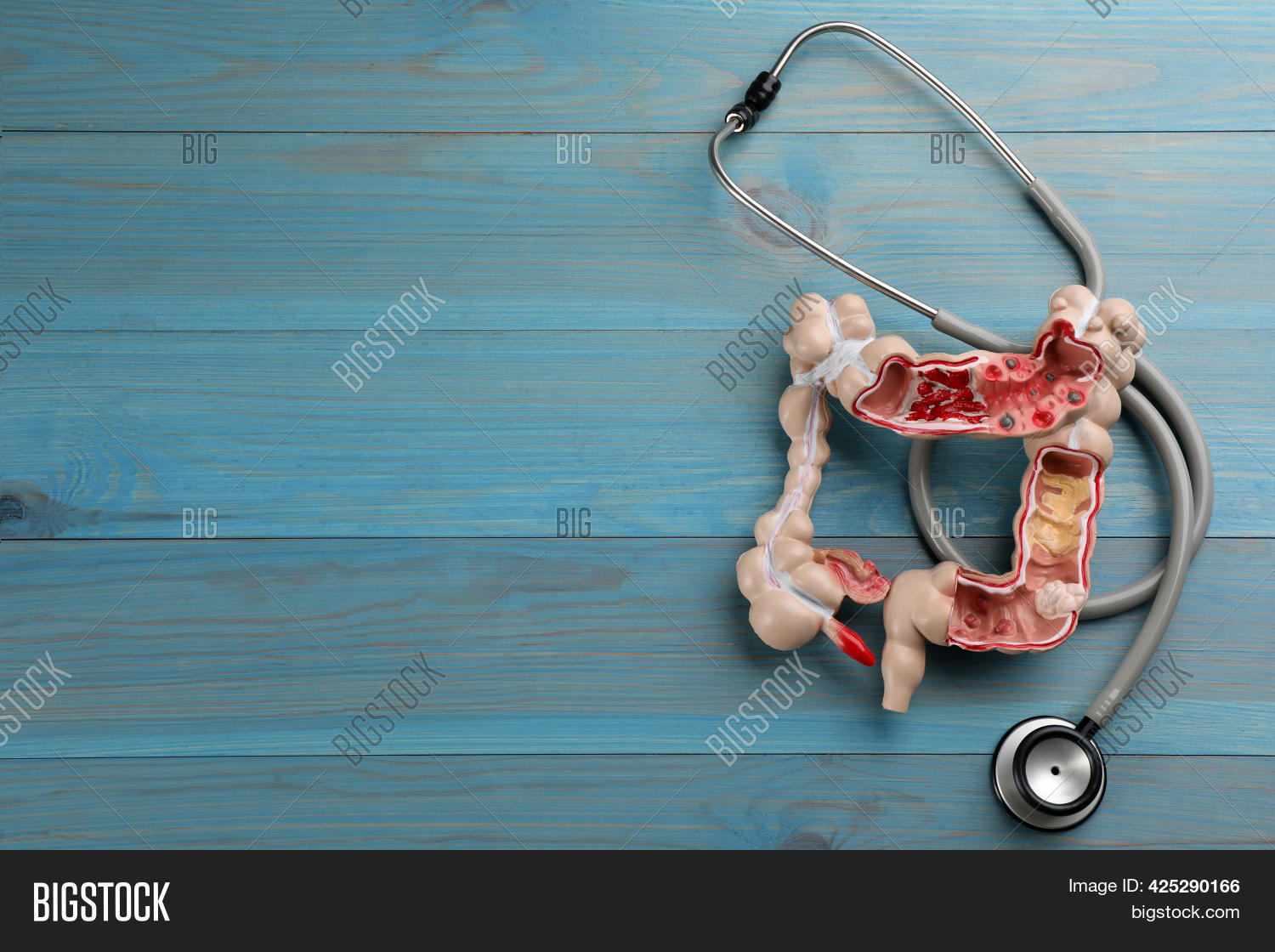 Human Colon Model Image & Photo (Free Trial) | Bigstock