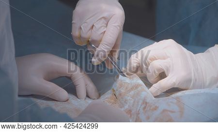 Hands Surgeons Cutting Image & Photo (Free Trial) | Bigstock