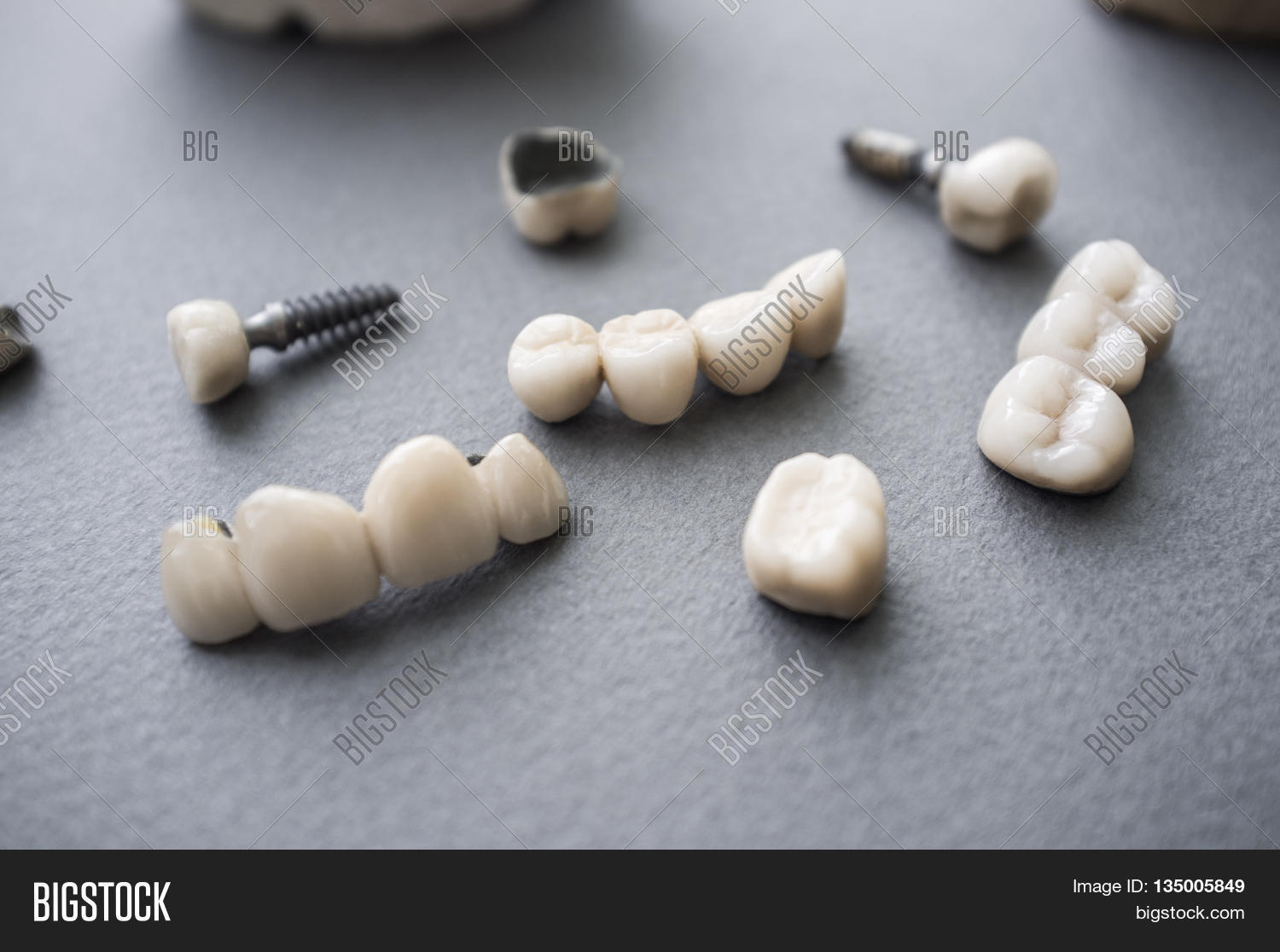 Ceramic Dentures Image & Photo (Free Trial) | Bigstock