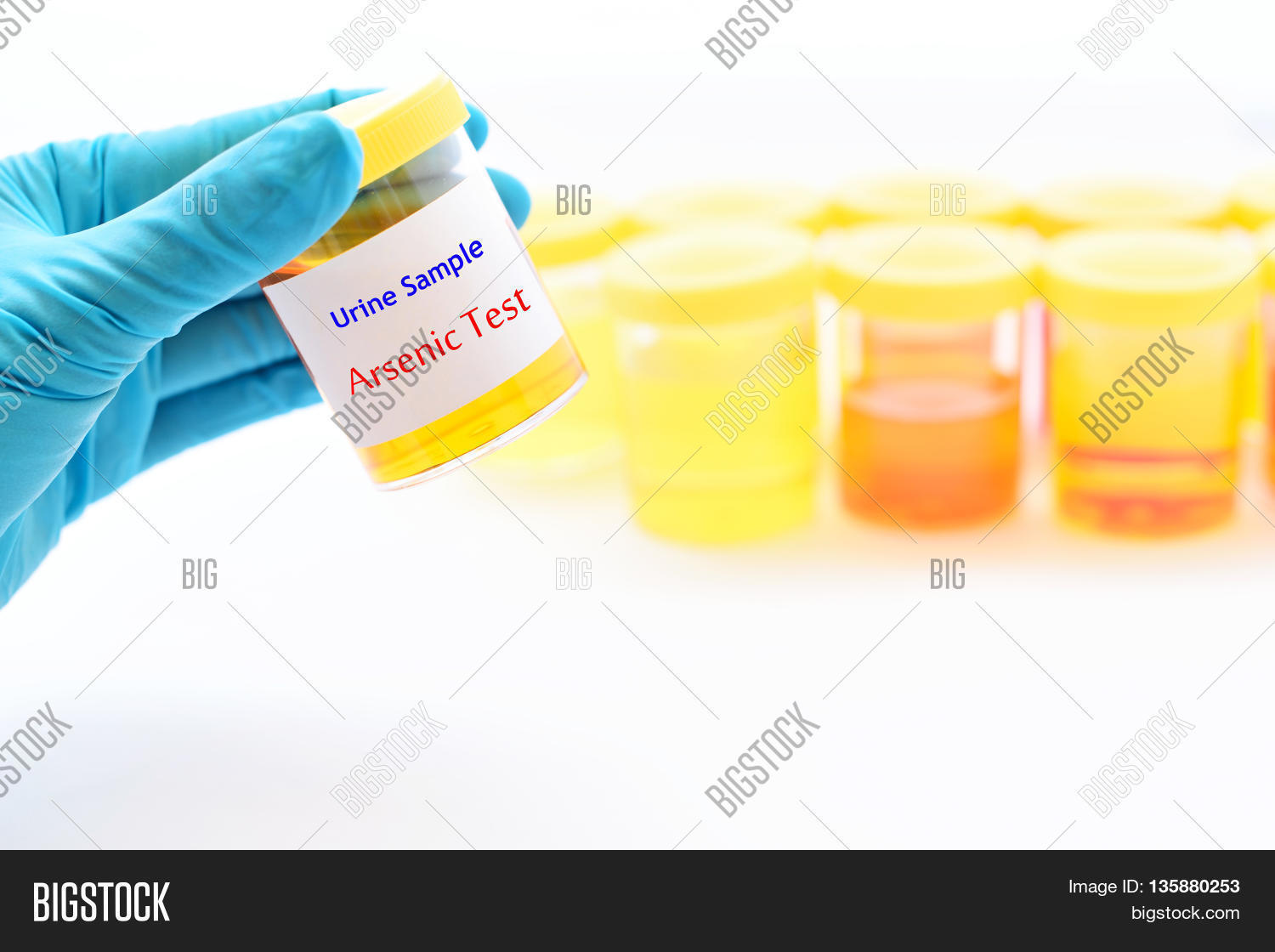 Arsenic Levels In Urine | Arsenic Poisoning: Symptoms, Causes, and ...