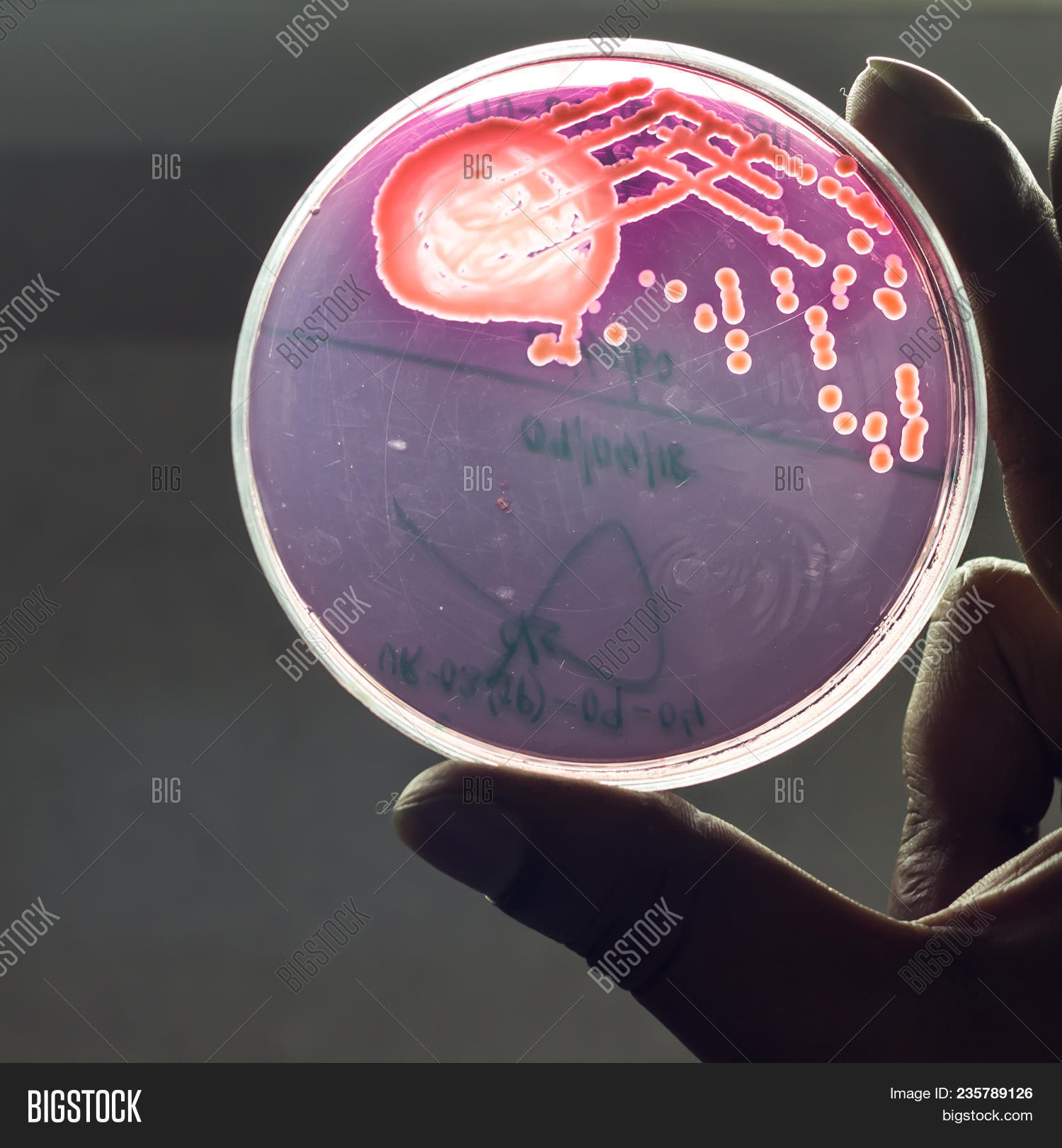 Bacterial Culture Image & Photo (Free Trial) | Bigstock