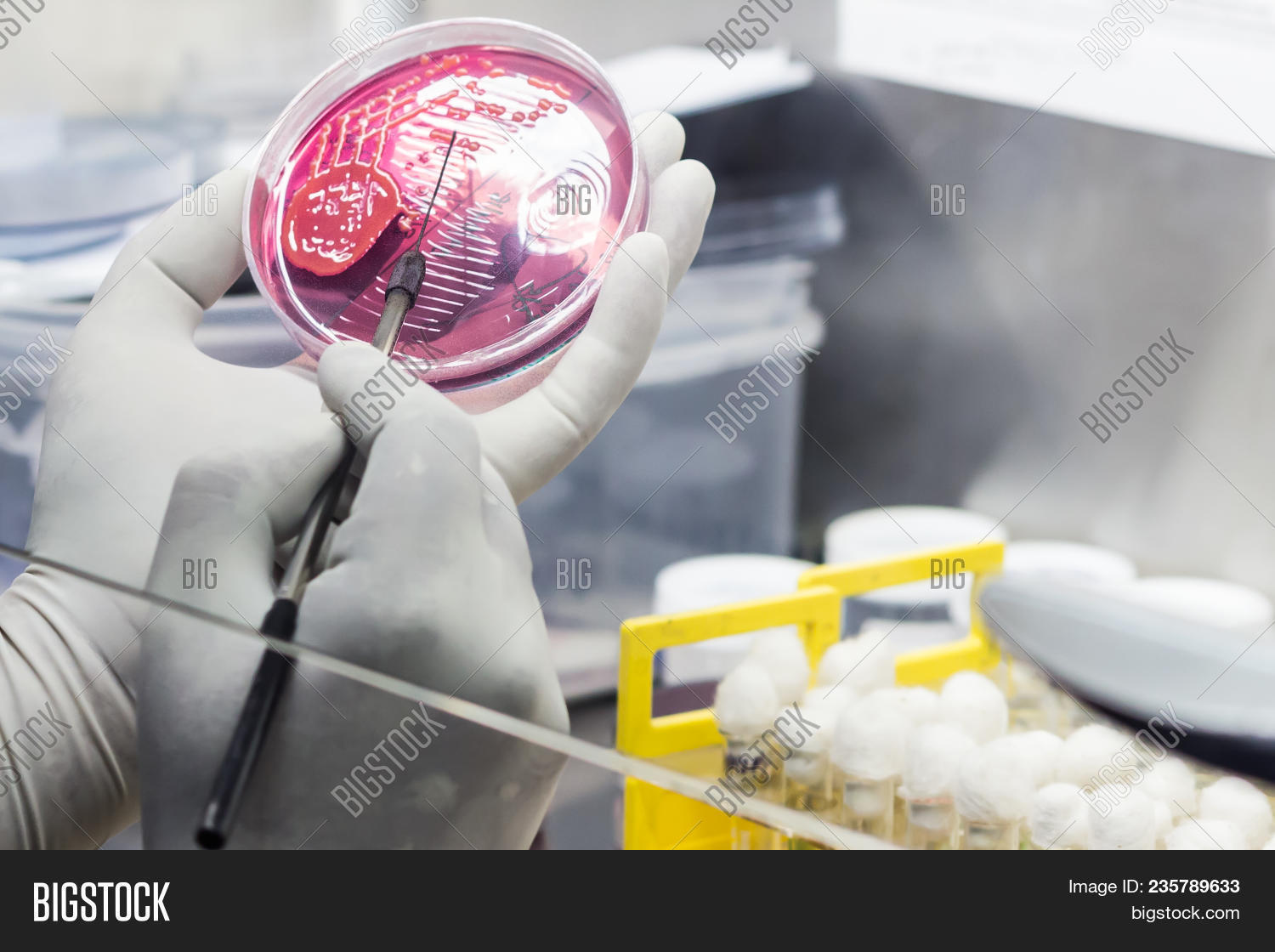 Bacterial Inoculation Image & Photo (Free Trial) | Bigstock