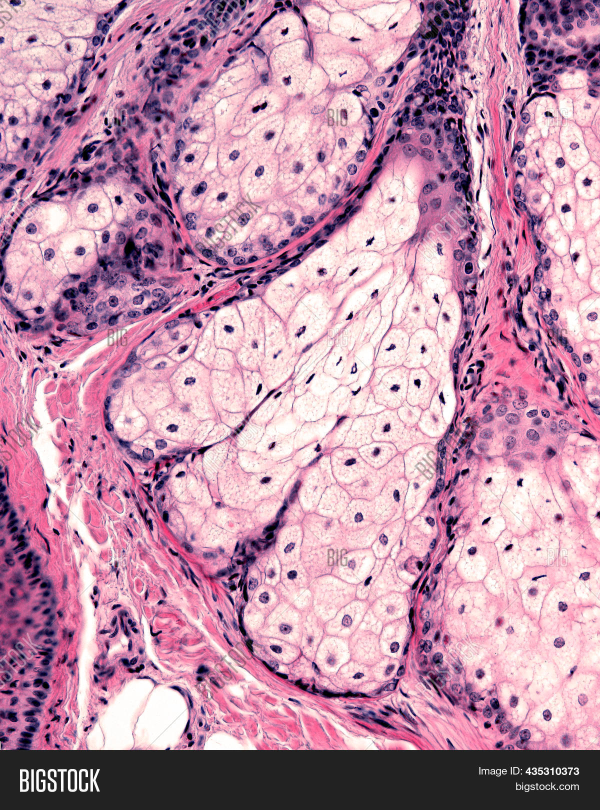 Sebaceous Gland Image & Photo (Free Trial) | Bigstock