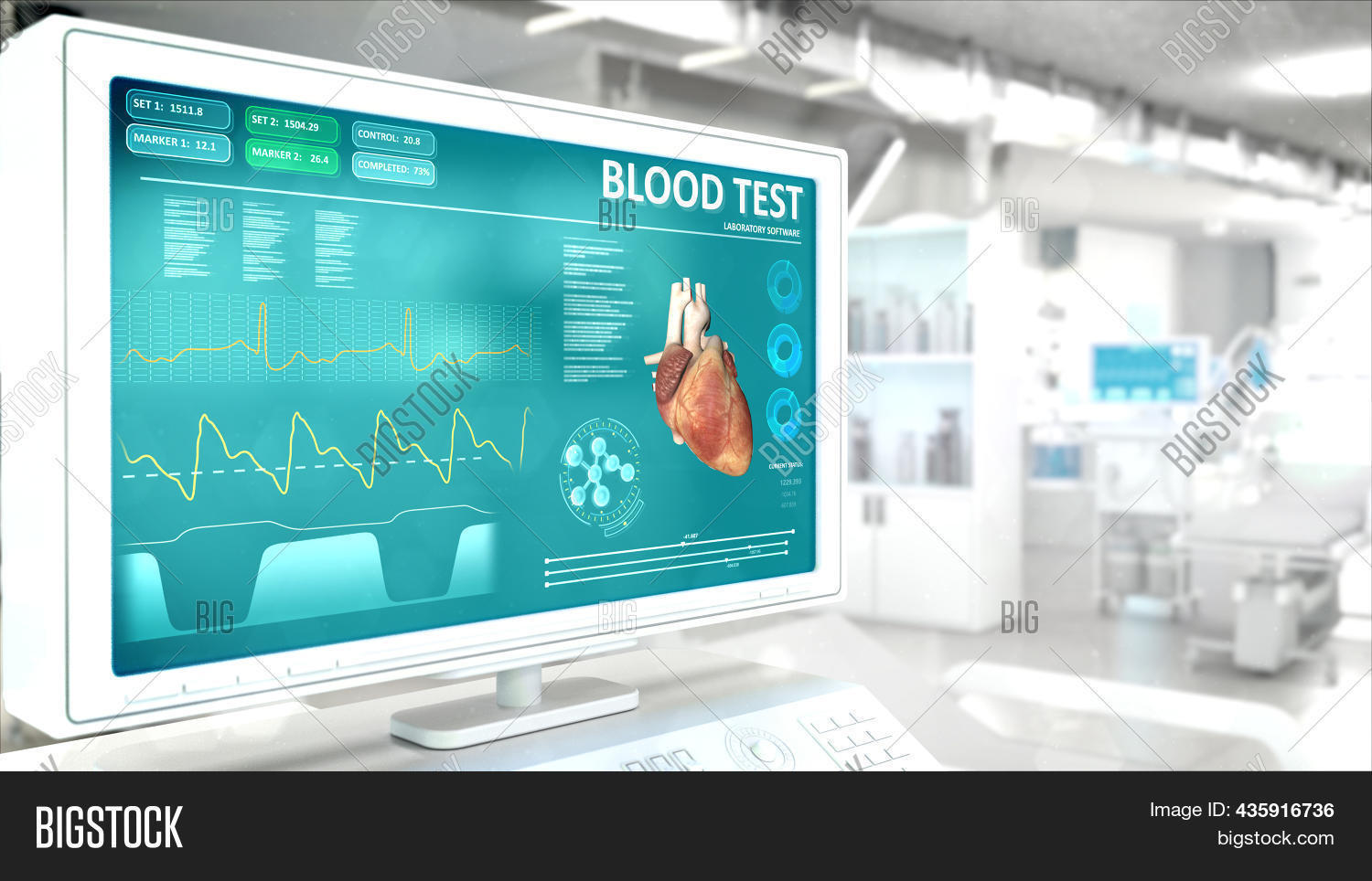 Blood Test On Monitor Image & Photo (Free Trial) | Bigstock