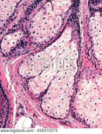 Sebaceous Gland Image & Photo (Free Trial) | Bigstock