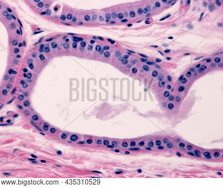 Columnar Simple Image & Photo (Free Trial) | Bigstock