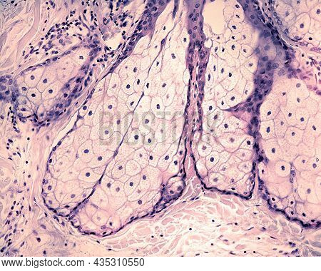 Sebaceous Gland. Image & Photo (Free Trial) | Bigstock